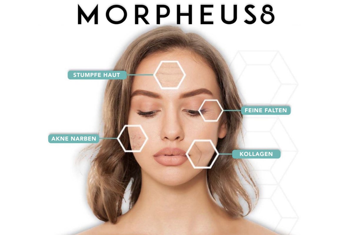 Morpheus 8 | BEAUTYCLINIC